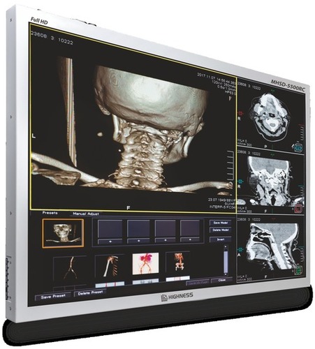 55 Inch Surgical Display Mhsd-5500Rc Built-In Recording And Storage at ...