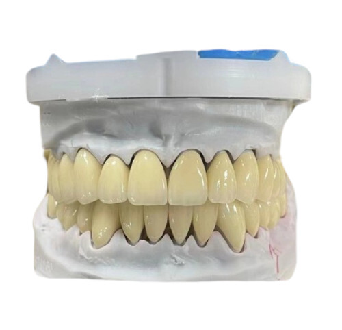 Dental Crown - Attributes: Biocompatible at Best Price in Shenzhen ...