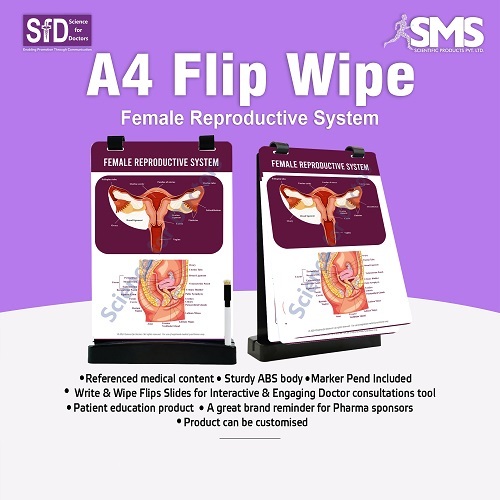 Female Reproductive System Flip Chart - Durable Abs Material A4 Size ...