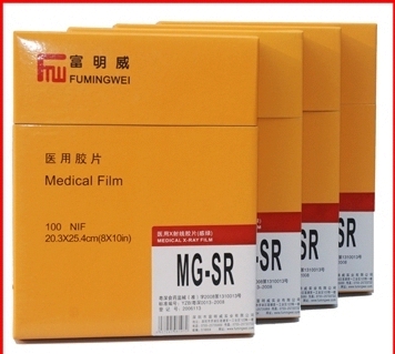 Medical X-Ray Green Sensitive Film at Best Price in Shenzhen | Shenzhen ...